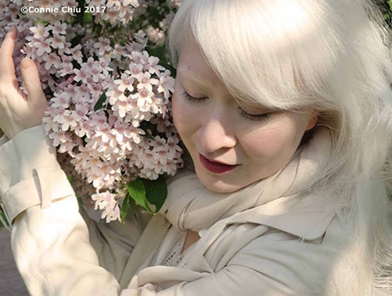 [ẢNH] Ngỡ ngàng trước vẻ đẹp khác biệt của những người mẫu bạch tạng ...